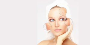 Papule: Causes, Symptoms, Treatments And Prevention Tips