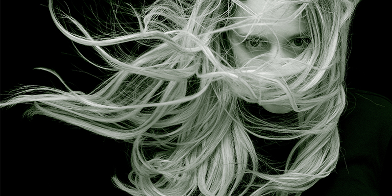 Laser Hair Removal For The Treatment Of Hypertrichosis