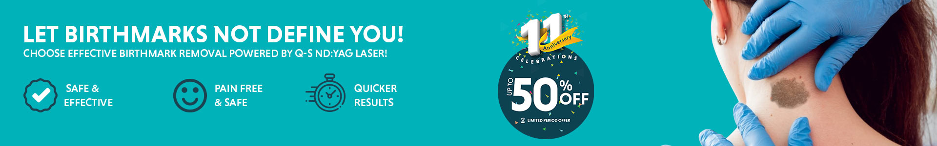 Birthmarks: Types, Causes And Treatment Options