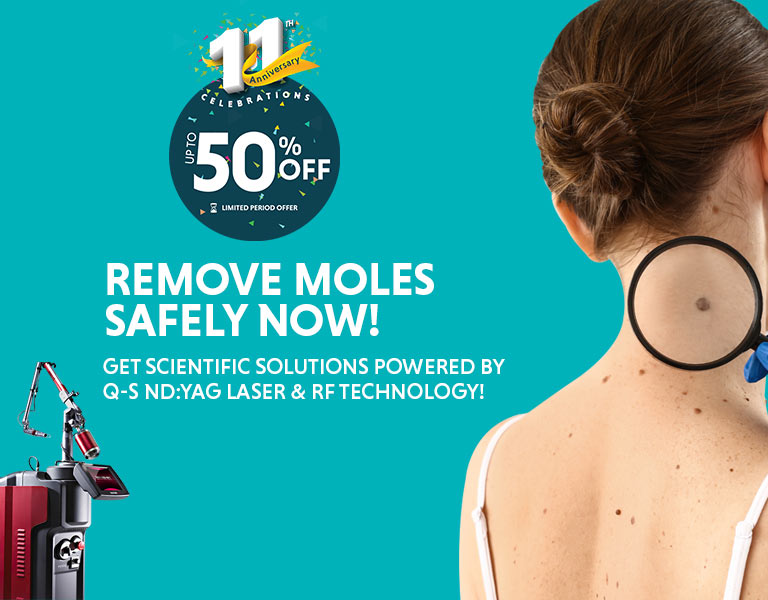 Moles : Common Causes And Management Options