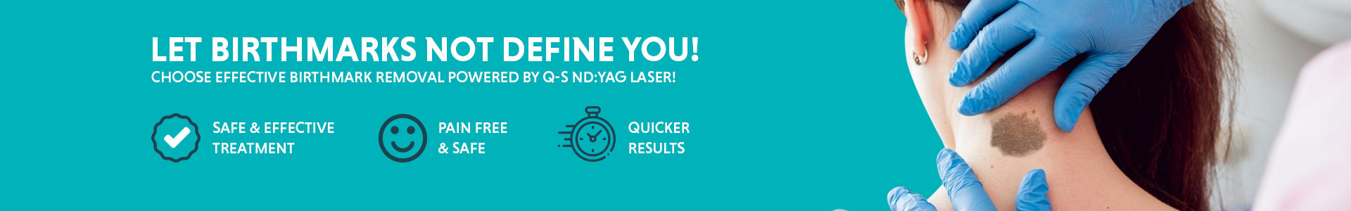 Birthmarks: Types, Causes And Treatment Options