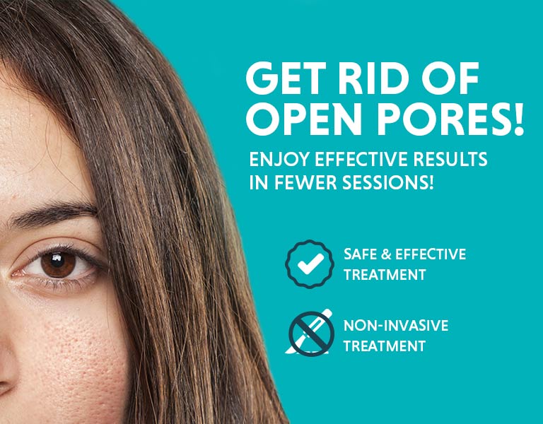 Open Pores: Causes, Treatments, Results & Prevention Tips