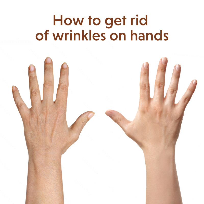 How To Remove Wrinkles From Hands - Treatments & Home Remedies