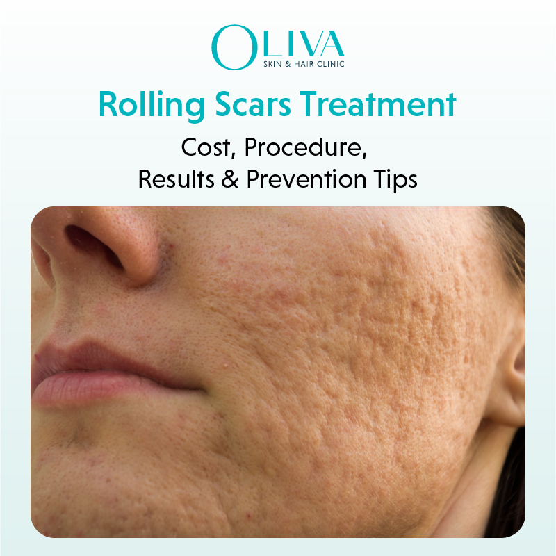 Skin Peeling On Fingertips: Causes, Treatments, Home Remedies & Prevention