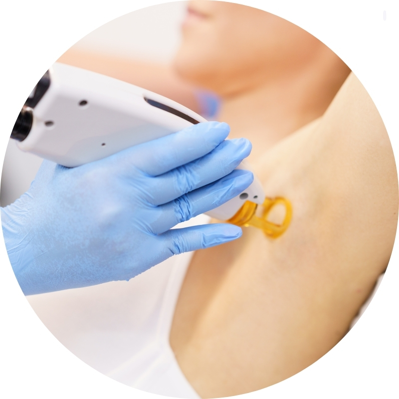 Black Pearl Underarm Treatment