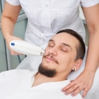 Laser Beard Shaping For Men: Cost, Benefits & Procedure