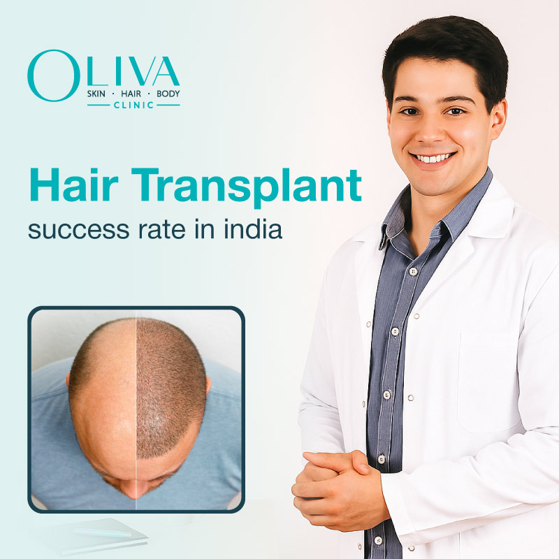 Hair Transplant Success Rate | Factors & Best Techniques Explained